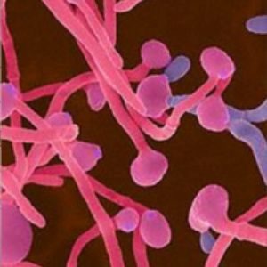 Candidiasis: factores, síntomas y tratamiento