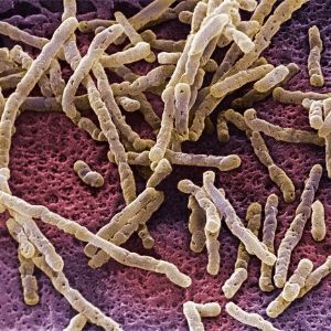 Candidiasis intestinal, cómo erradicarla